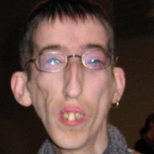 Adam Cerebain biotech (@ADAMCHURCH1CBBT) | Stocktwits